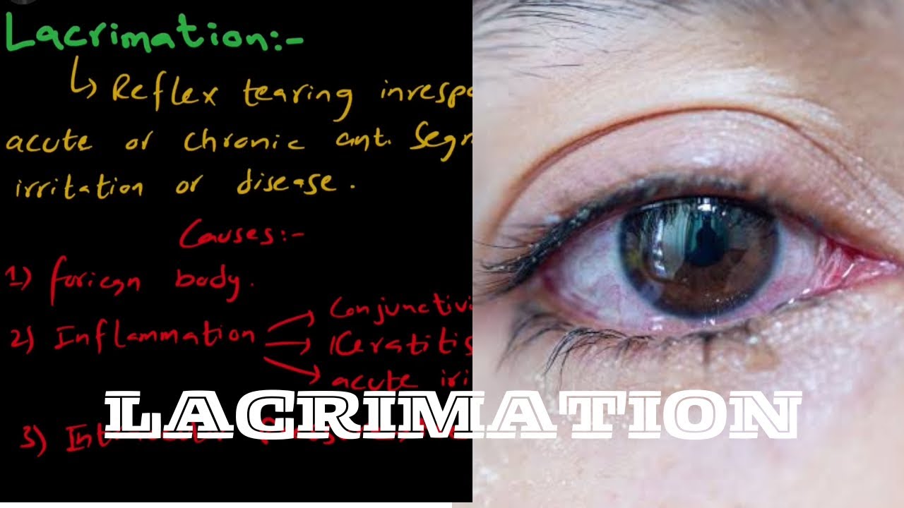 LACRIMATION | Watery Eye - YouTube