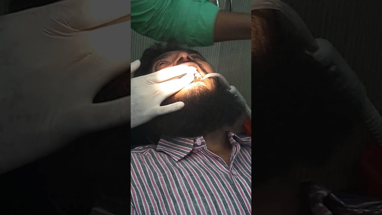 Teeth Complete rehabilitation treatment by Dr.vijay kumar.MDS dental ...