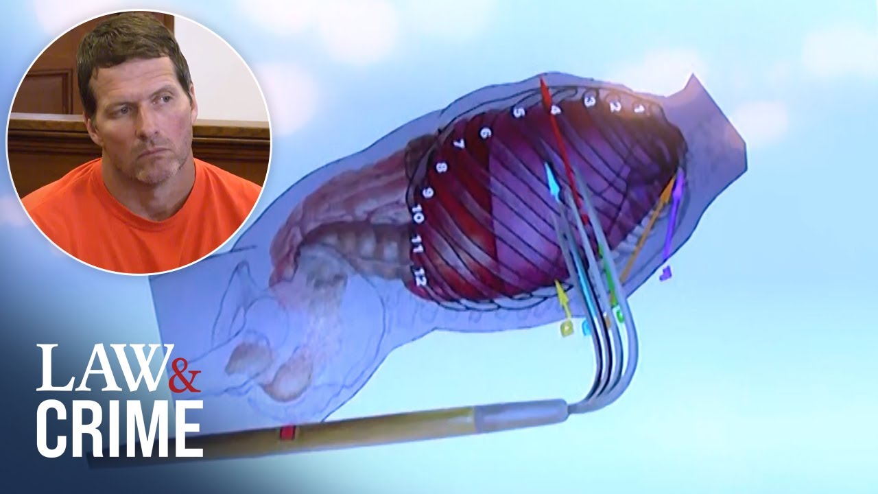 Expert Witness Analyzes Corn Rake’s Deadly Trajectory in Pig Farmer’s ...