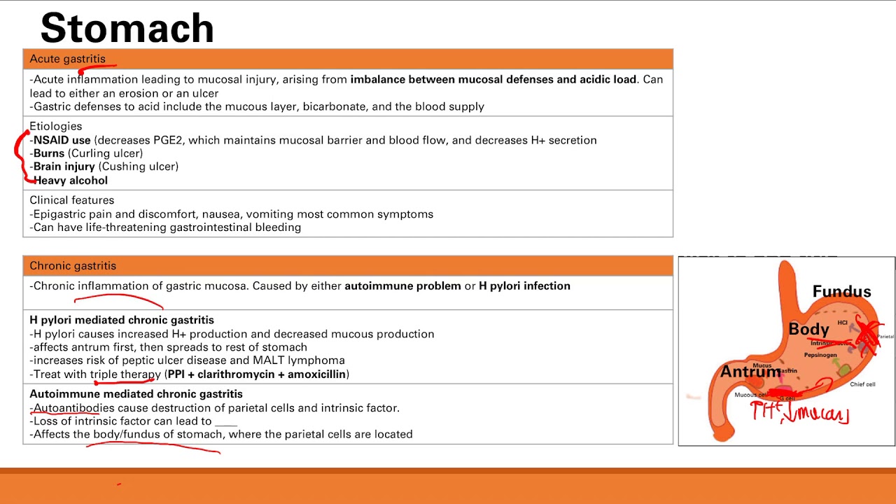 Stomach Pathology | GI system | Step 1 Simplified - YouTube