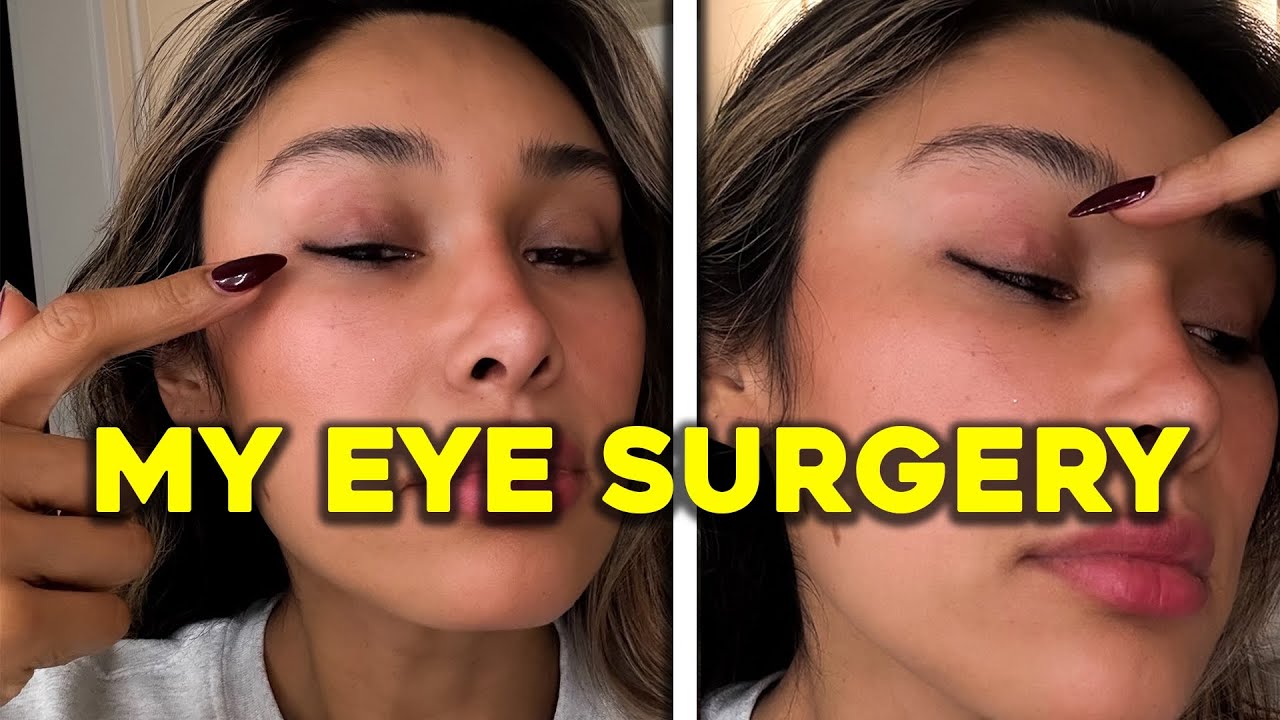 I Got Eye Surgery! What Happened and Why I'm Doing It - YouTube