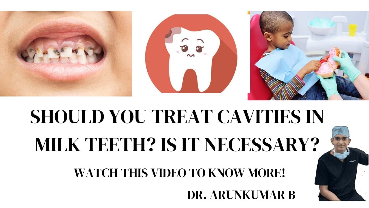 Decay in Milk Teeth? Can we Ignore them? Dr Arunkumar Pearls Dentistry ...