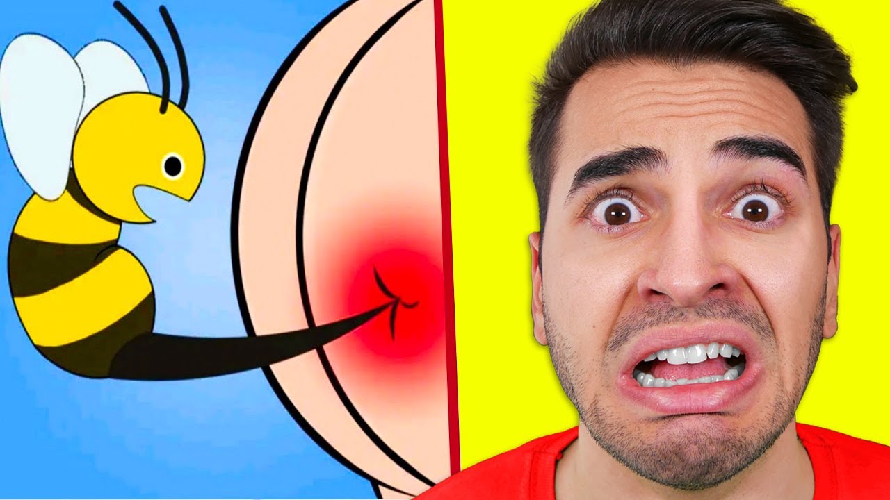 NON FARTI PUNGERE SUL SEDERE - BRAIN HELP US - YouTube