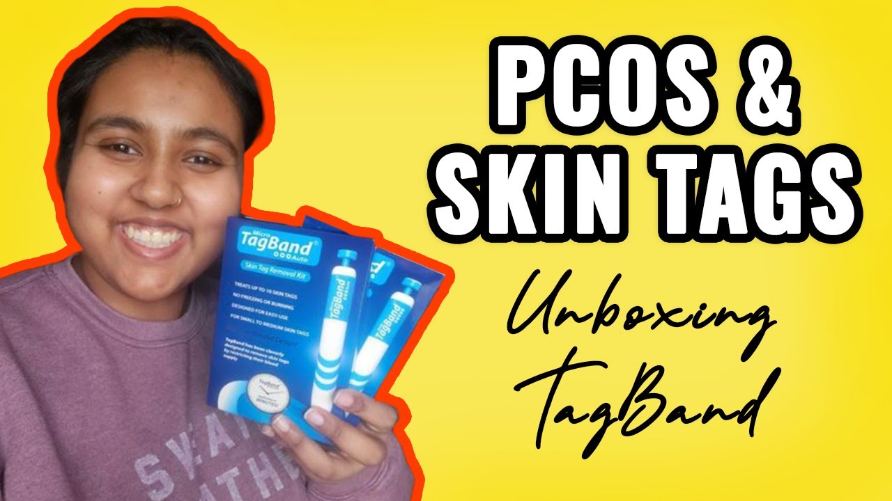 PCOS Skin tags removal // Unboxing TagBand and first thoughts! # ...