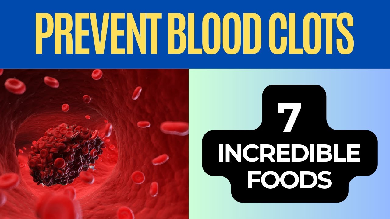 Best Foods To Stop Blood Clots at Natalie Hawes blog