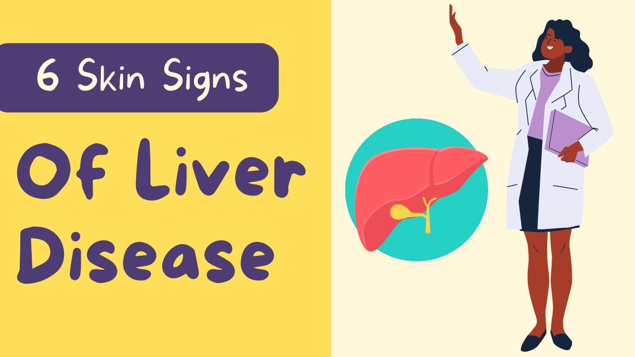 5 unexpected skin changes caused by liver disease || How your skin can ...