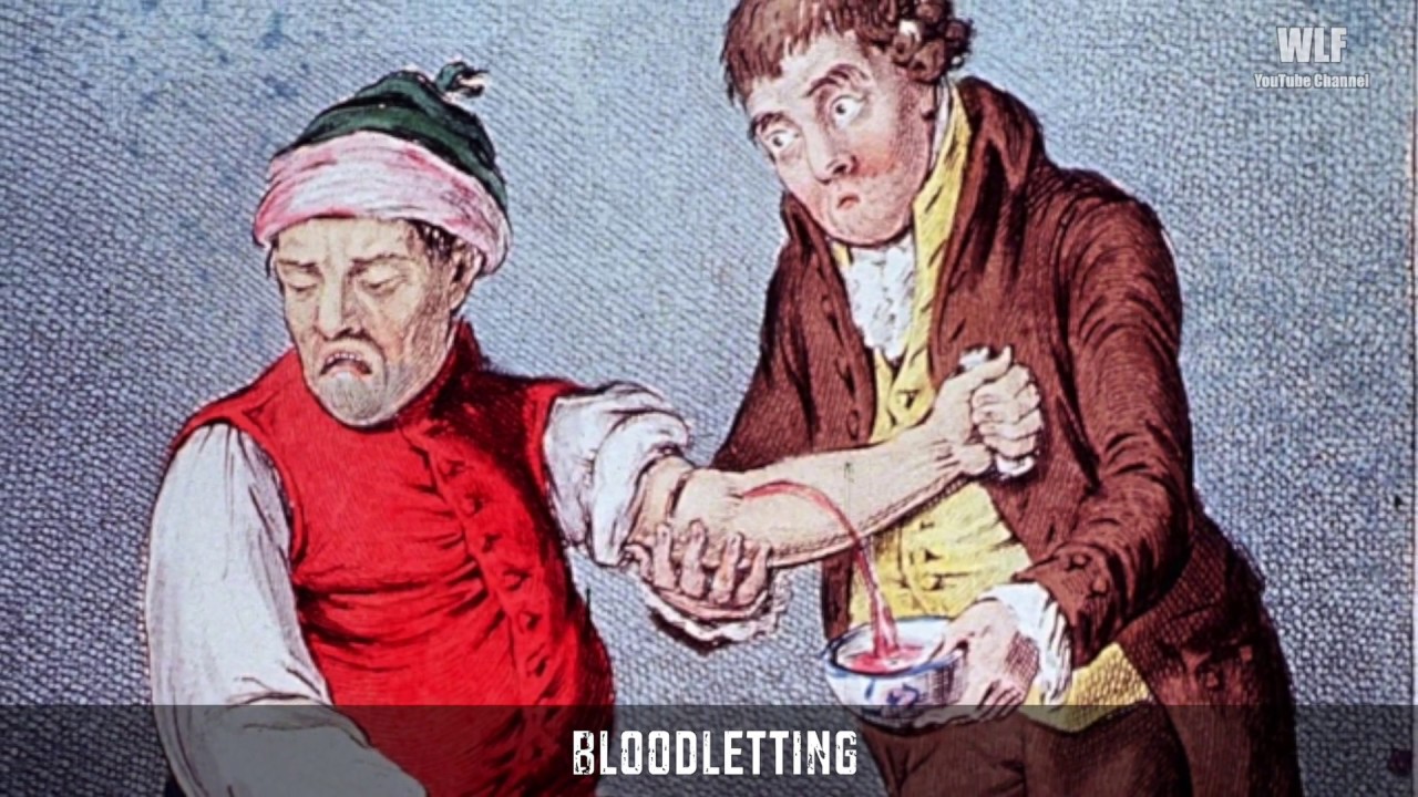 10 Most Bizarre Medical Treatments Ever - YouTube