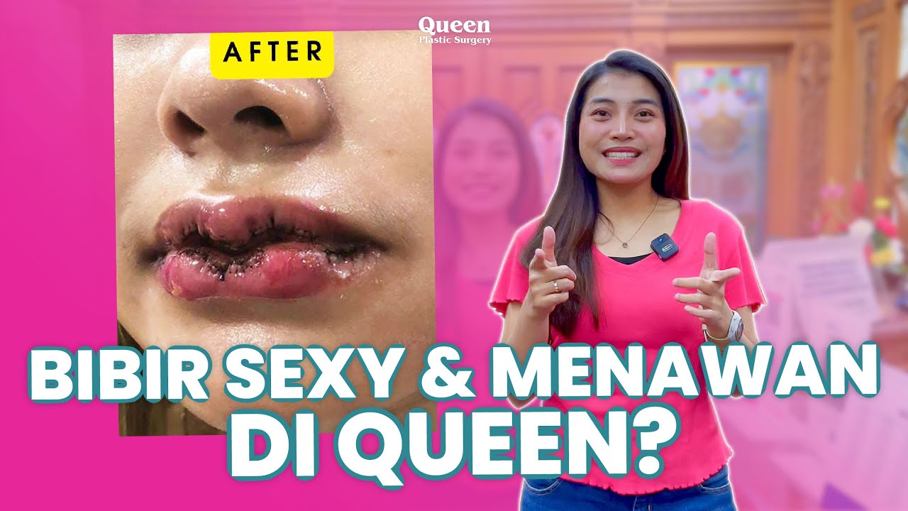 BIKIN BIBIR JADI SEKSI INDAH DAN MENAWAN DENGAN OPERASI BIBIR LOVE DI ...