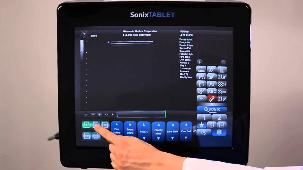 sonixtablet quickstart 1280 - YouTube