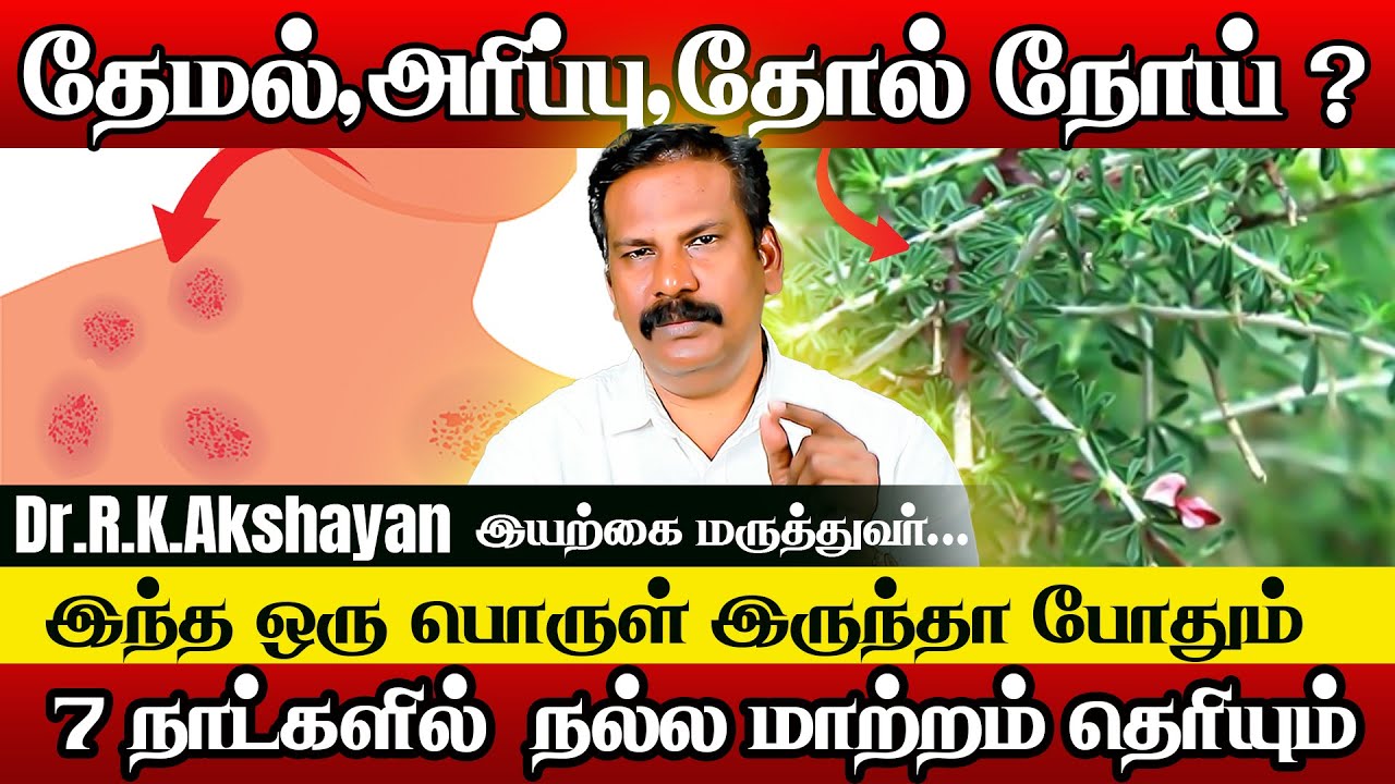 எப்பேர்பட்ட தோல் பிரச்சனையையும் உடனே சரிசெய்யும் மூலிகை | Dr.RK ...