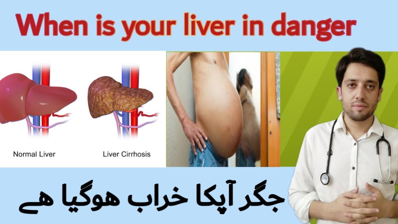 SHOCKING Signs Your Liver is in DANGER! Don't Ignore These Red Flags by ...