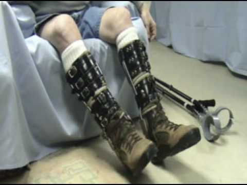Leg Braces in the chair - YouTube
