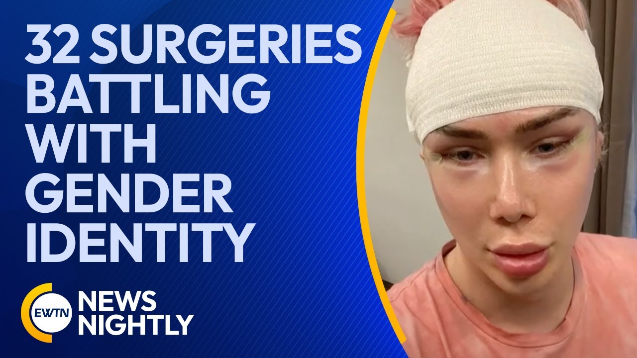After 32 Surgeries to Battle Self Image Issues, Oli London Found God ...