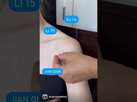 Where Are Acupuncture Needles Placed For Shoulder Pain