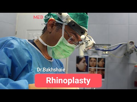Rhinoplasty in Iran Mashhad by Dr.Bakhshaie best nose job surgeon | medvika