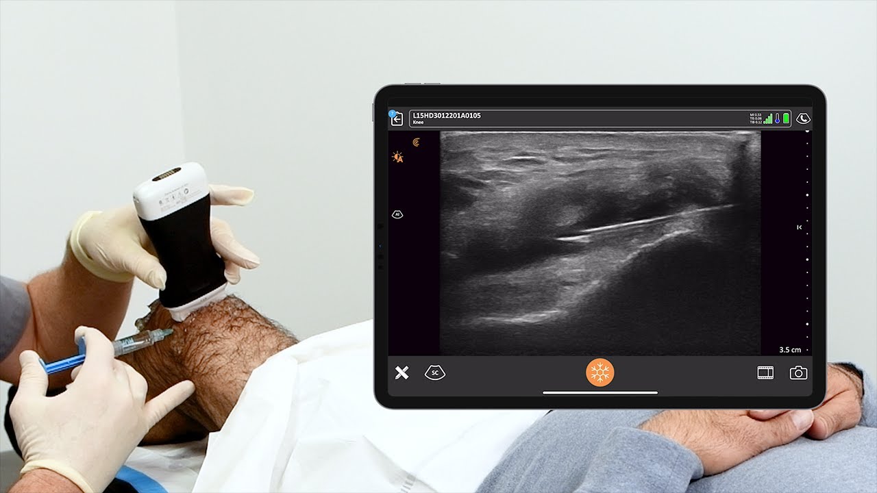 MSK AI and Knee Joint Injection - YouTube