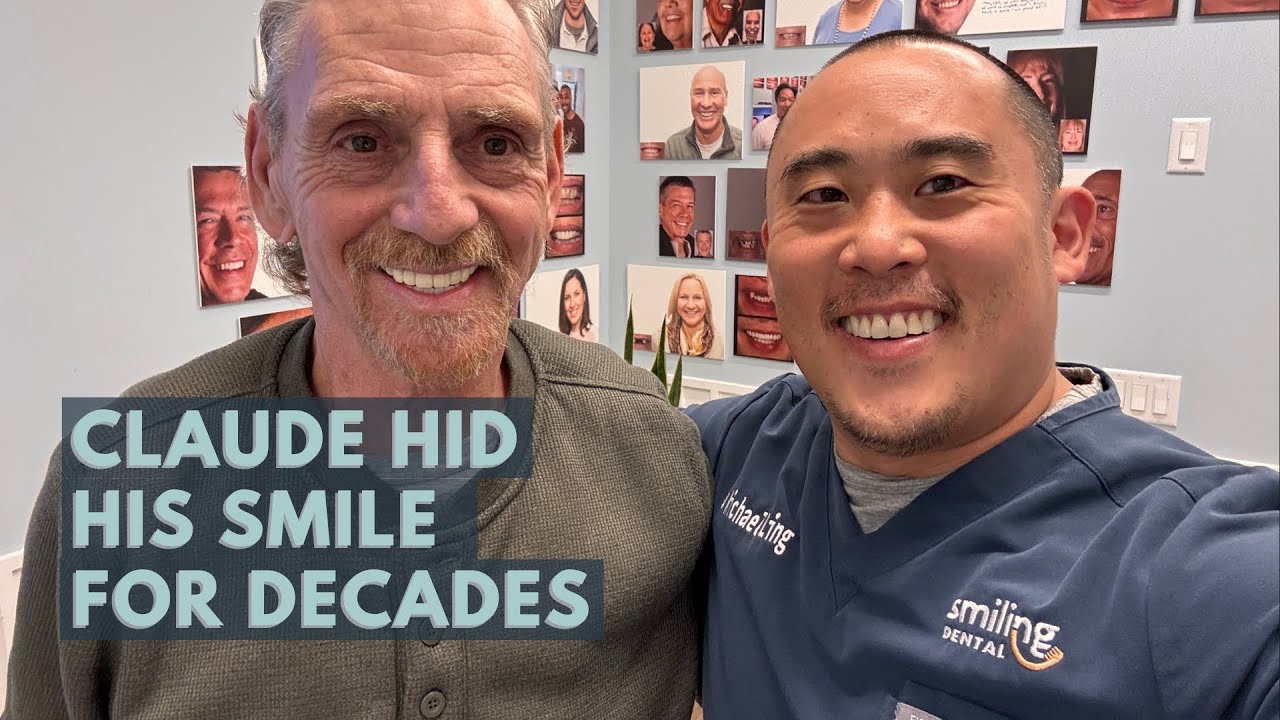 Claude hid his smile for decades - YouTube