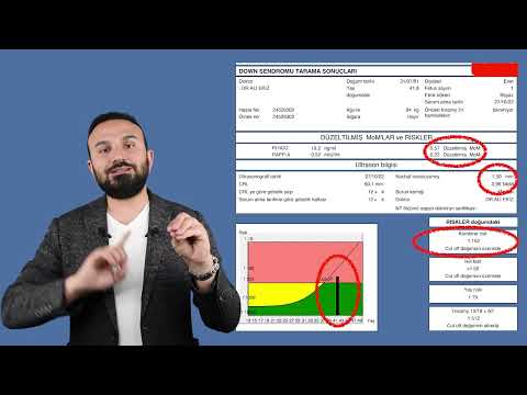 Bebeğime Down dediler normal çıktı! Bu doğru olabilir mi? I Doç. Dr. Ali Ekiz