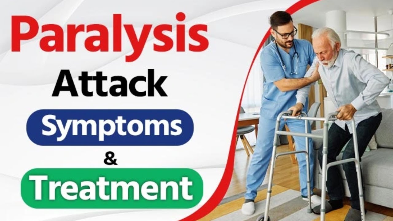 Stroke Attack |Left Side Paralysis |Paralysis Treatment- فالج کاعلاج ...