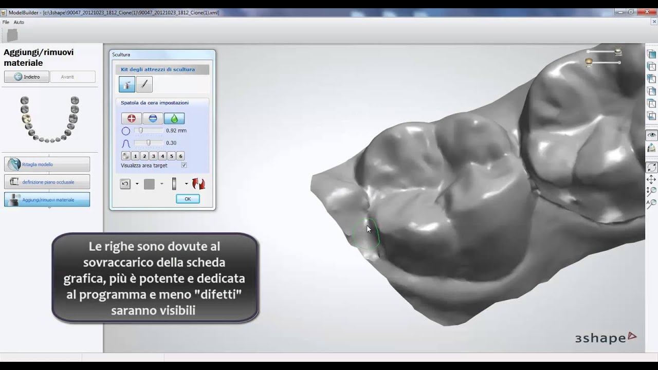 Model Builder 3Shape - YouTube