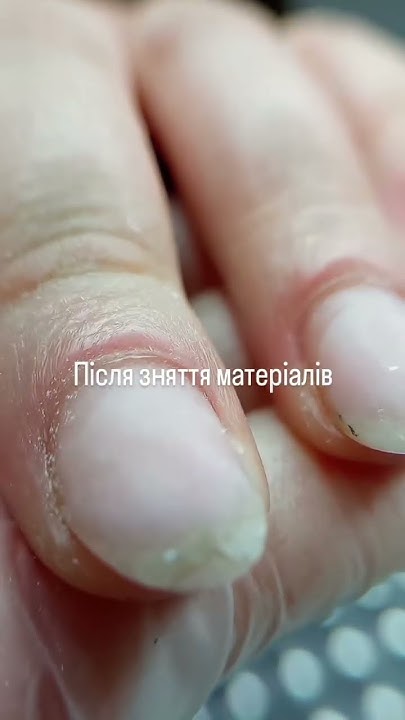 нігті після зняття матеріалів Nails Youtube
