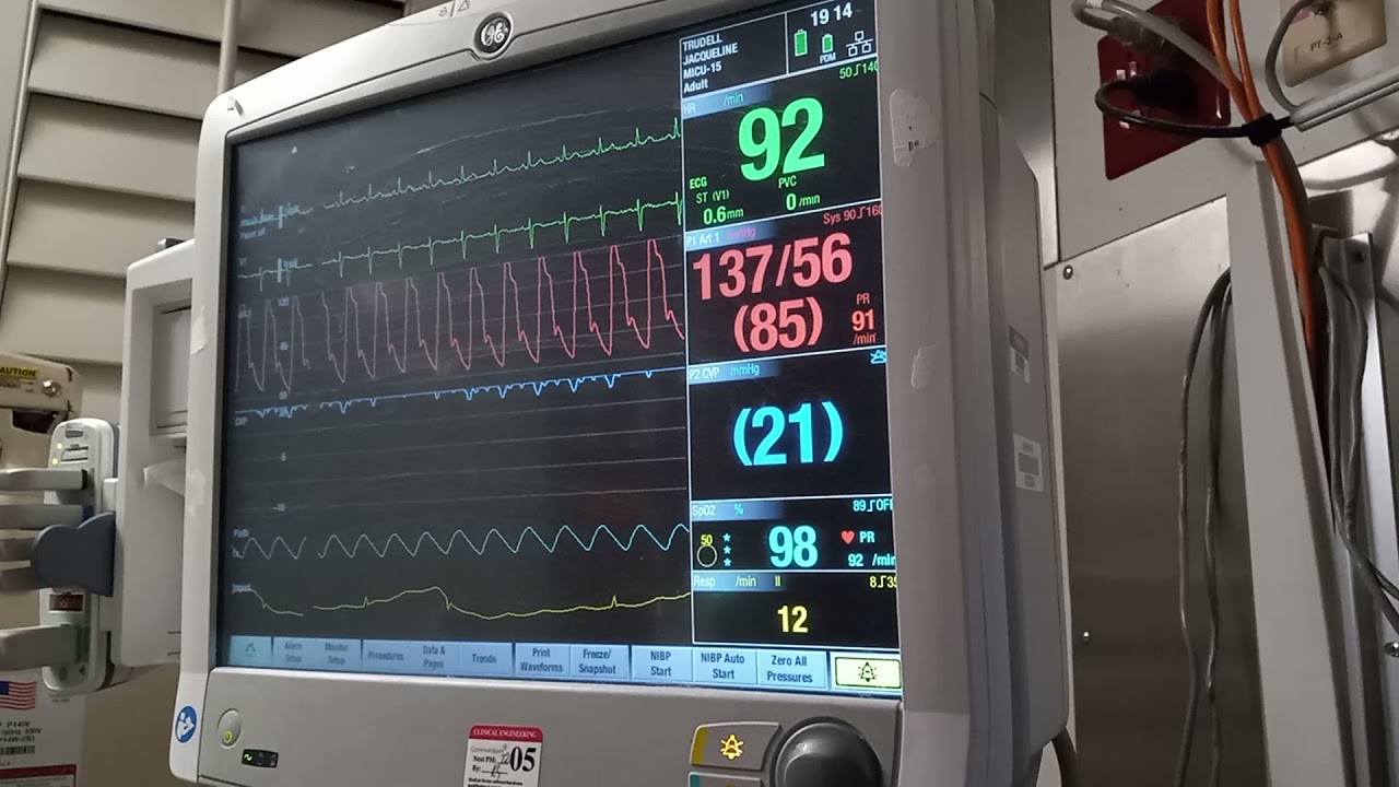 Vitals, ICU - YouTube