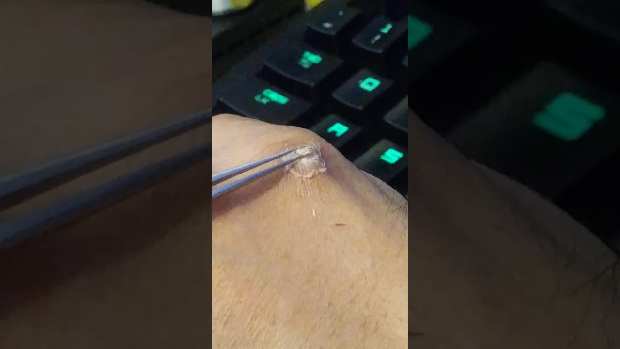 remove scab satisfy - YouTube