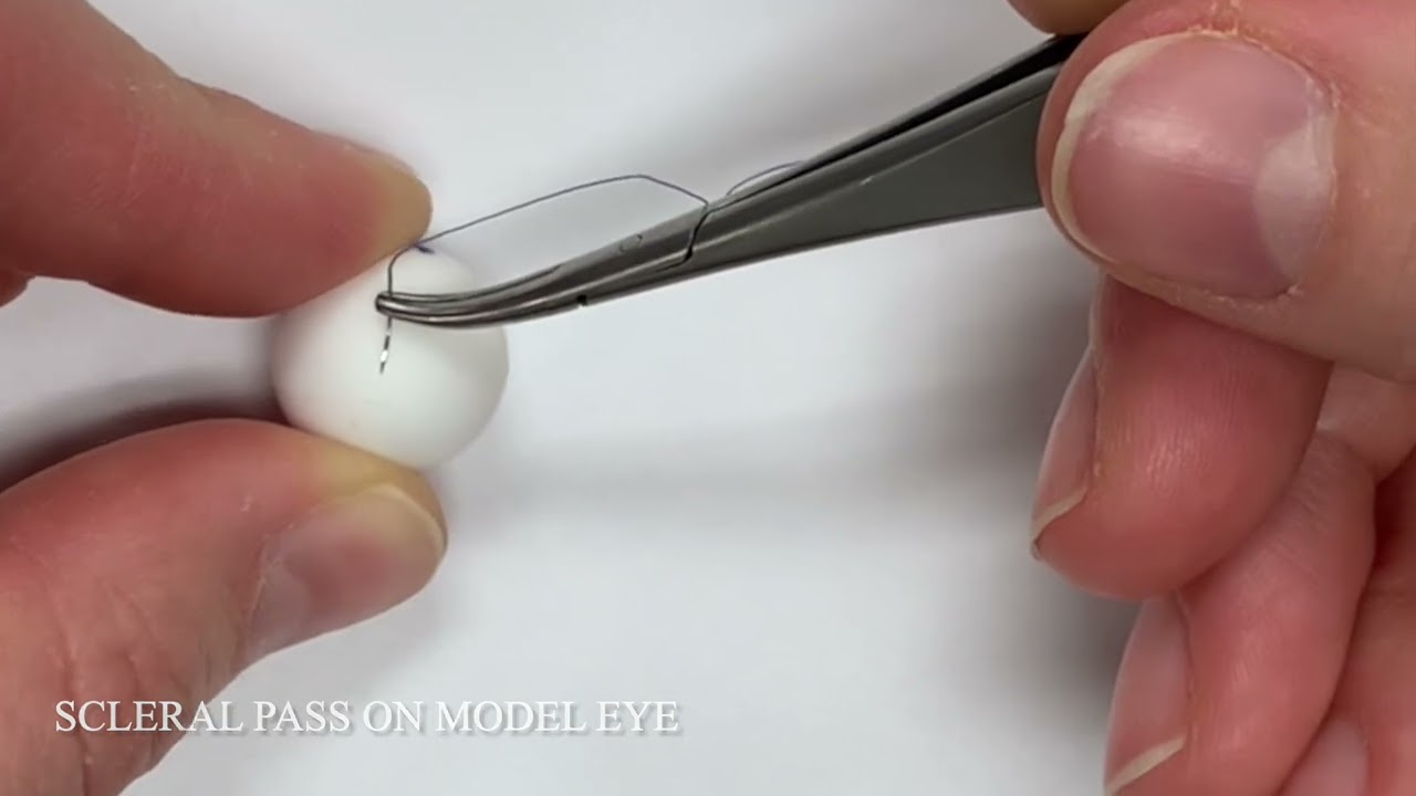 Principles of Scleral Pass in Strabismus Surgery - YouTube