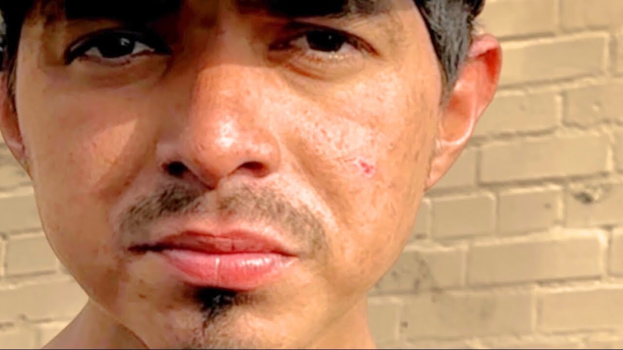 Raymond 28 Homeless On Blues For 6 Years - YouTube