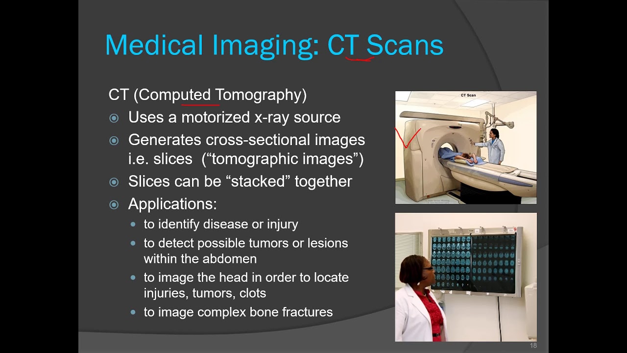 Lec 29: Applications of DIP | Sonar and Medical Imaging (Lec Date: 24 ...