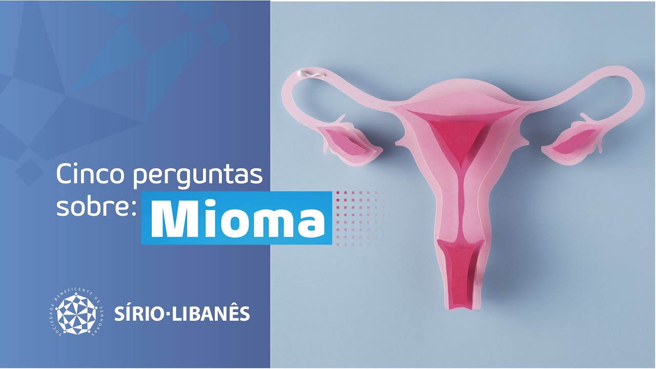 Miomas: entenda o que são e como tratá-los - YouTube