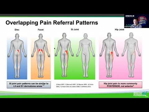 Si Joint Pain Referral Patterns