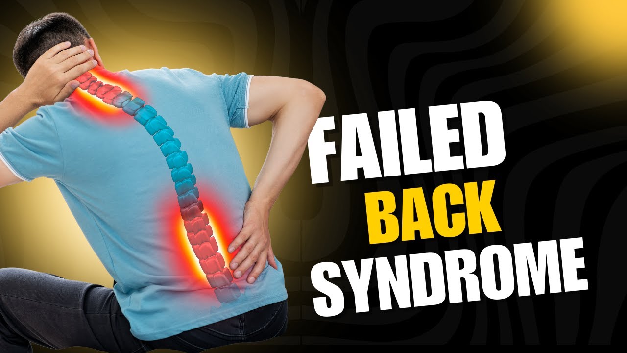 Fail Back Syndrome explained by Nityal Physio - YouTube