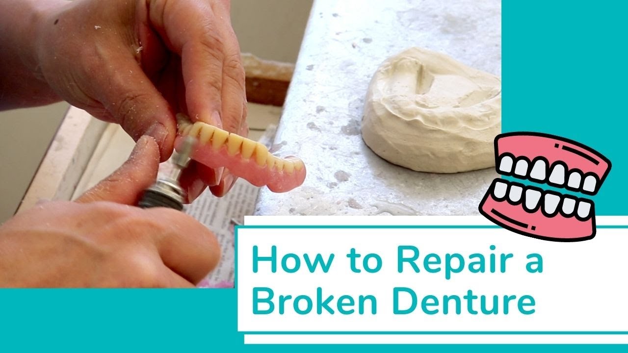 How to Repair a Broken Acrylic Denture - YouTube