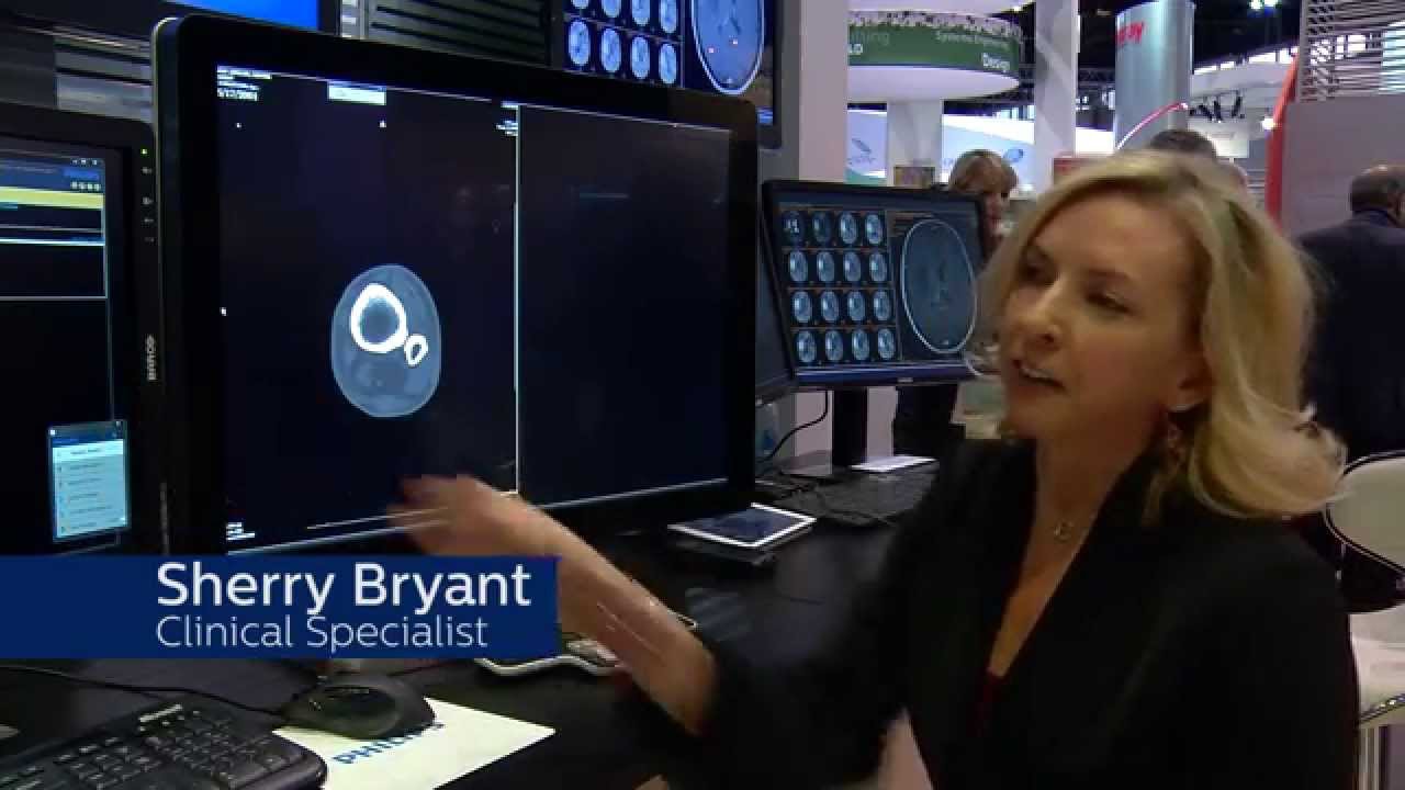 RSNA 2015: IntelliSpace PACS demo - YouTube