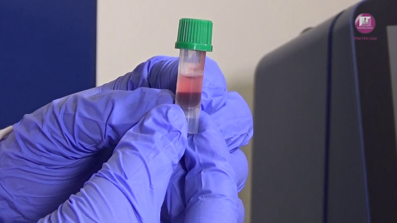 Pemeriksaan Hematologi Rutin dan Kimia Klinik - YouTube
