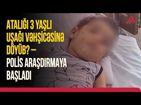 Lənkəranda uşaq vəh*icəsinə DÖYÜLDÜ: Anası “YIXILIB” DEDİ | APA TV