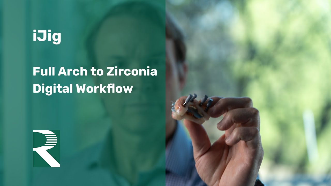 iJig: Full Arch to Zirconia Digital Workflow - YouTube