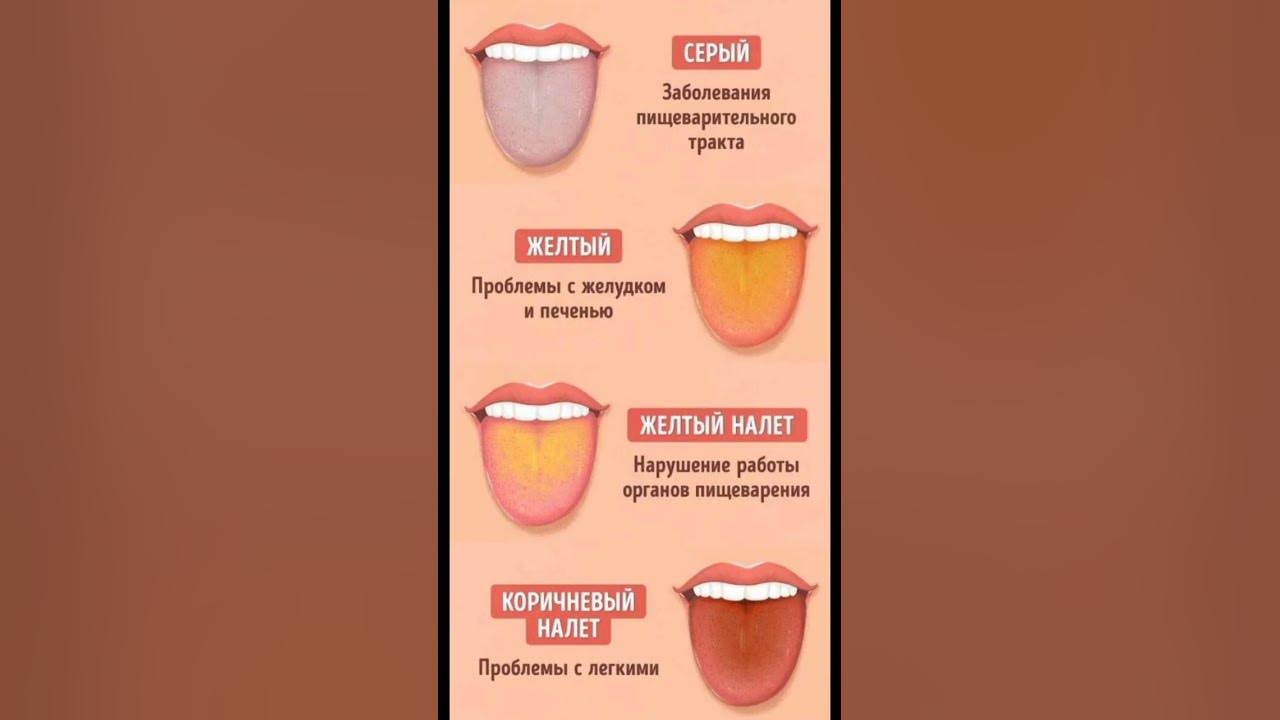 12 ПРОБЛЕМ, О КОТОРЫХ МОЖЕТ РАССКАЗАТЬ ЦВЕТ ЯЗЫКА - YouTube