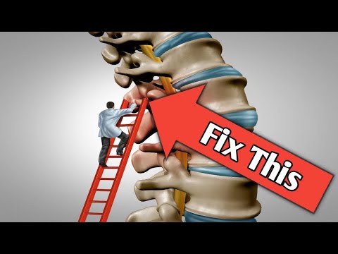 How To Fix Back Pain-Spinal Stenosis-Everything You Need To Understand ...