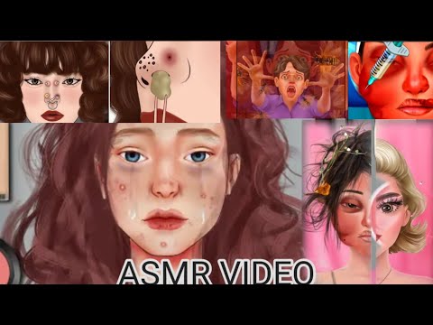 ASMR CARE ANIMATION ASMR REMOVAl ASMR EAR PIMPLE makeup ASMR # ...