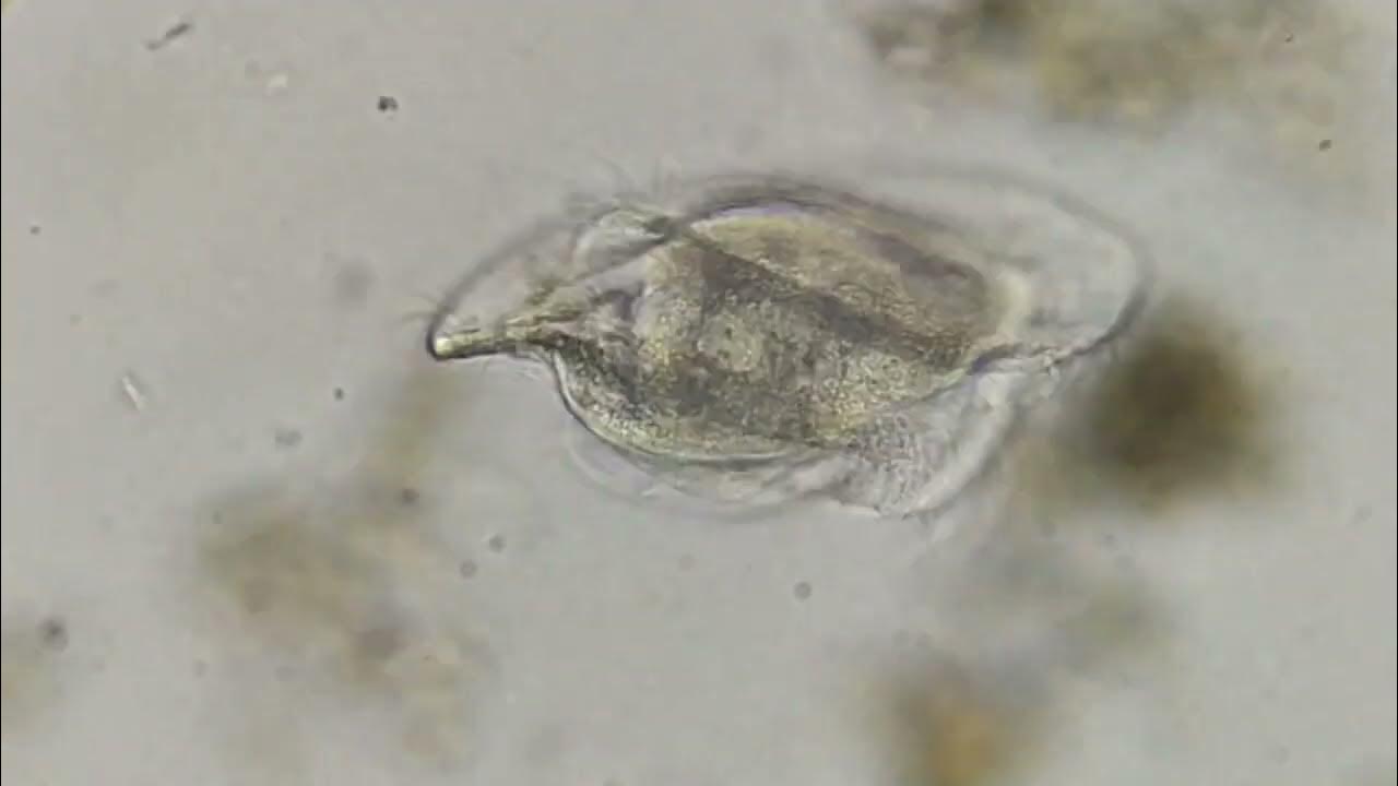 Phacodinium metchikoffi, ciliado muy llamativo. - YouTube