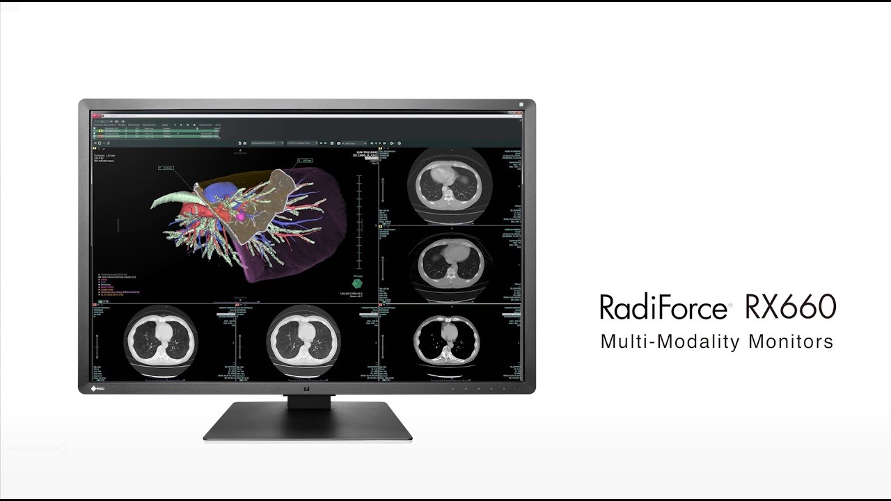 RX660 Product Demo - RSNA2020 - YouTube