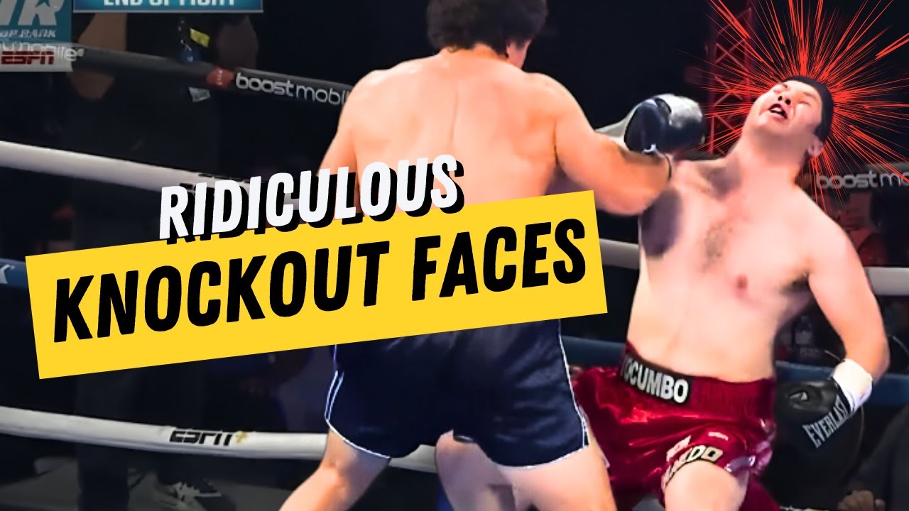 When you get knocked out so hard your face looks different... - YouTube