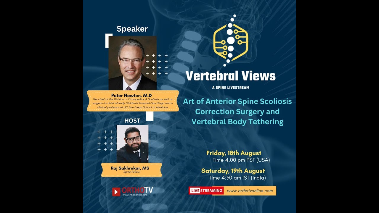 Art of Anterior Spine Scoliosis Correction Surgery and Vertebral Body ...