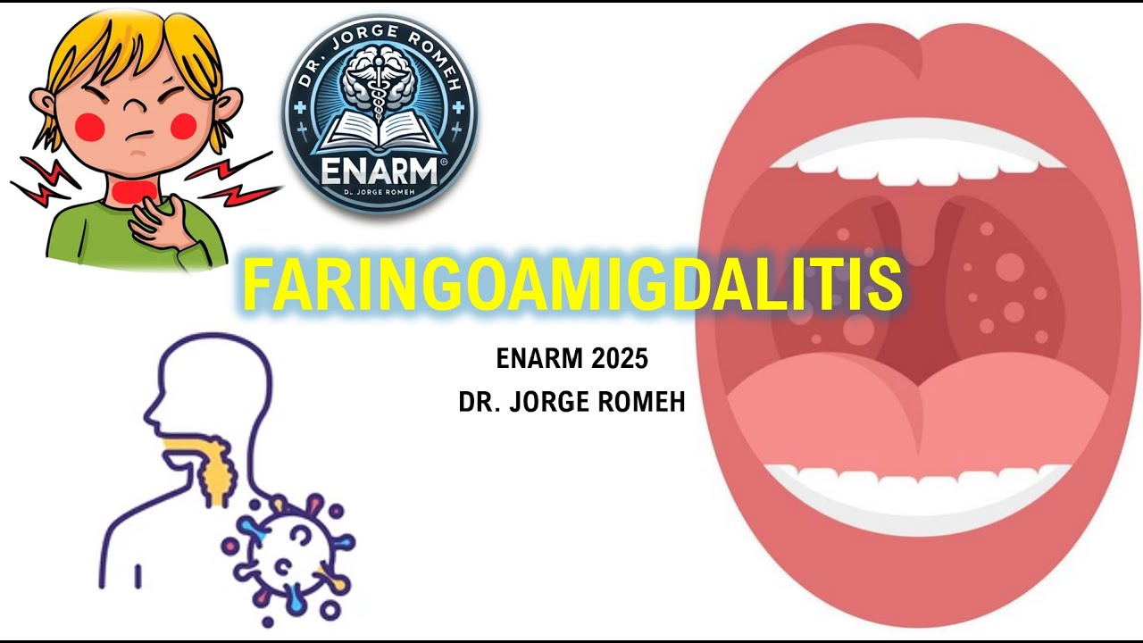FARINGOAMIGDALITIS - ENARM 2025 - TODO LO QUE TIENES QUE SABER - YouTube