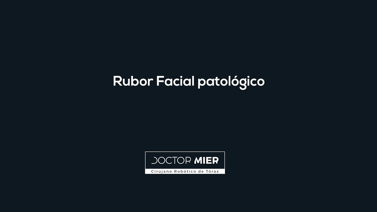 RUBOR FACIAL PATOLÓGICO - YouTube