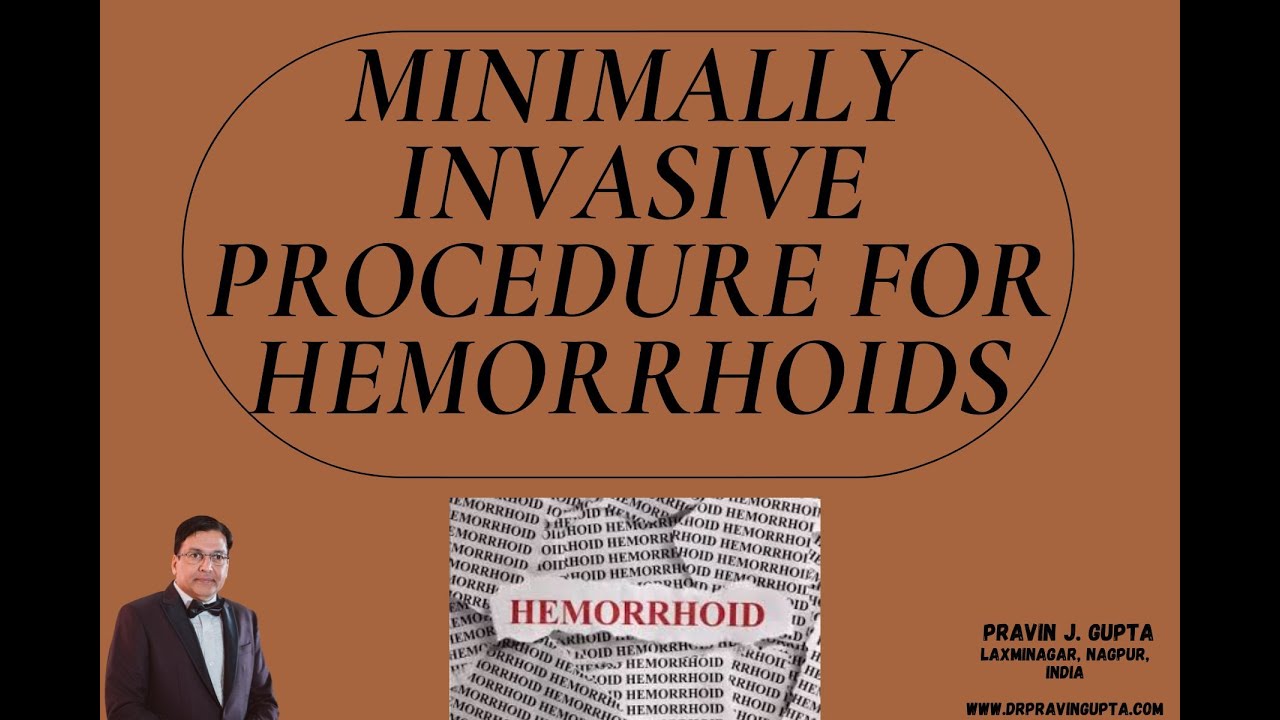 BLEEDING HEMORRHOIDS- A FAST AND MINIMALLY PAINFUL PROCEDURE - YouTube