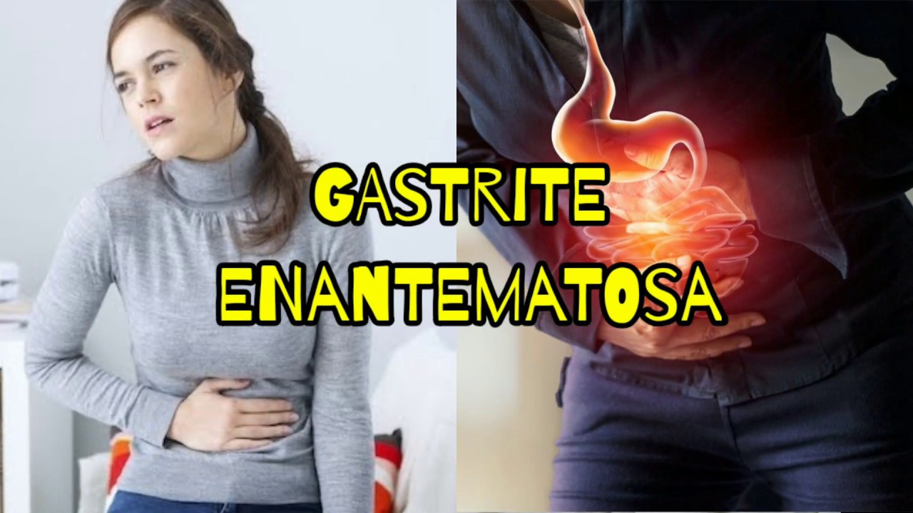 🔴 O QUE É PANGASTRITE E SINTOMAS - YouTube