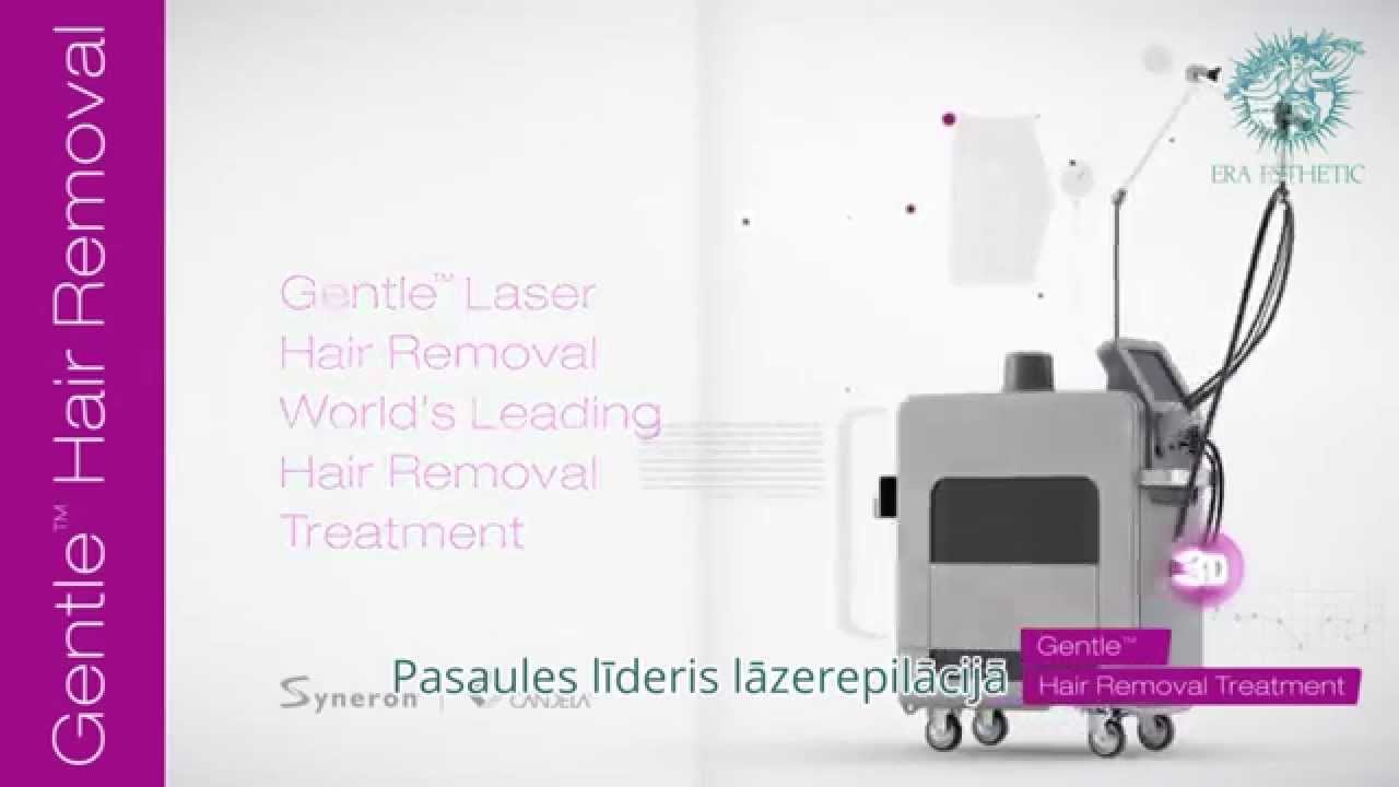 Lāzerepilācija ar jaunāko aleksandrīta lāzeru GentleLase Pro - YouTube